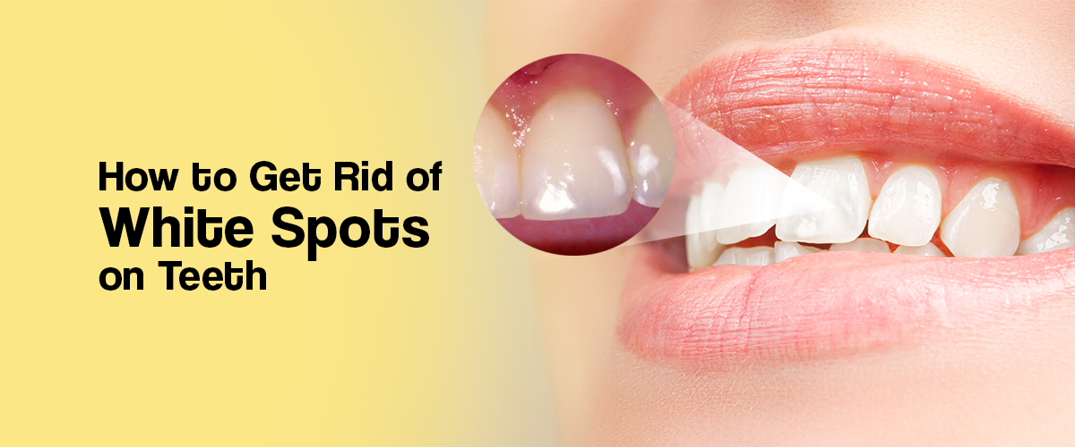 Which Toothpaste Is Best for Teeth